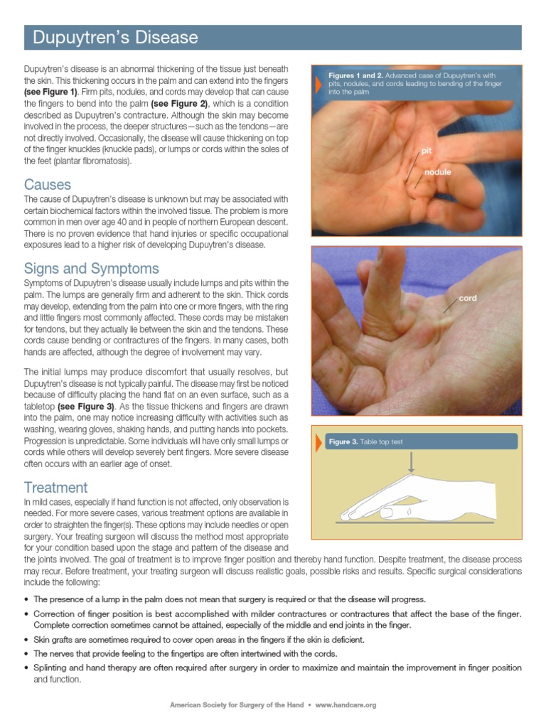Dupuytren's Disease Causes Finger Contractures | PDF | Human Diseases ...