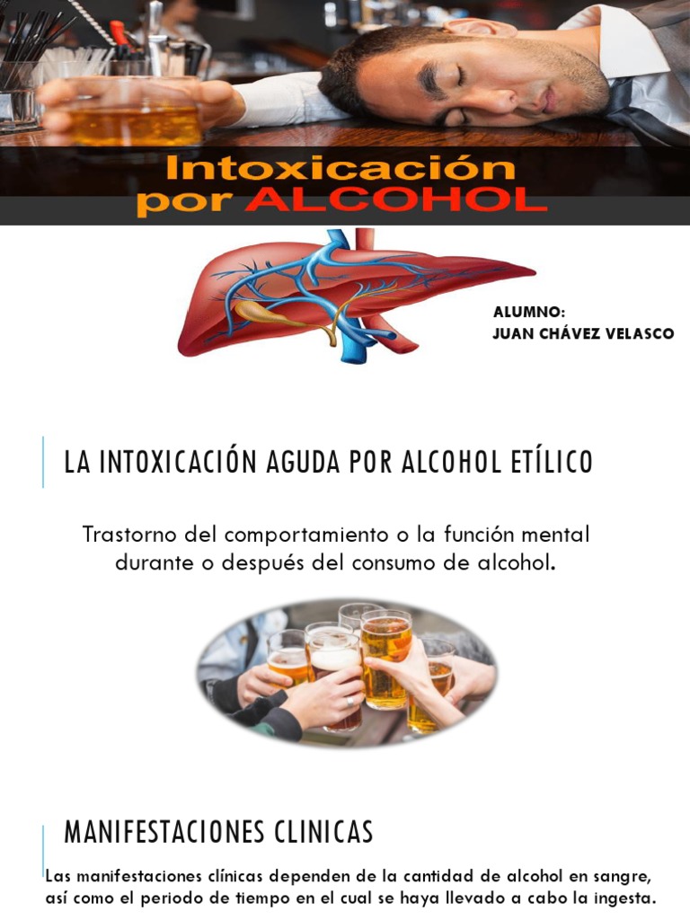 La Intoxicación Aguda Por Alcohol Etílico | PDF | Etanol | Hipoglucemia