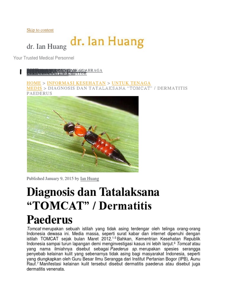 Diagnosis Dan Tatalaksana "TOMCAT" / Dermatitis Paederus: Dr. Ian Huang ...
