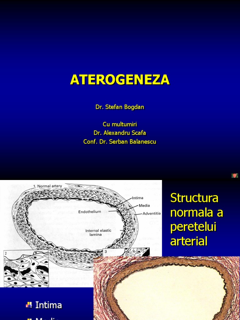 Aterogeneza: Dr. Stefan Bogdan Cu Multumiri Dr. Alexandru Scafa Conf ...