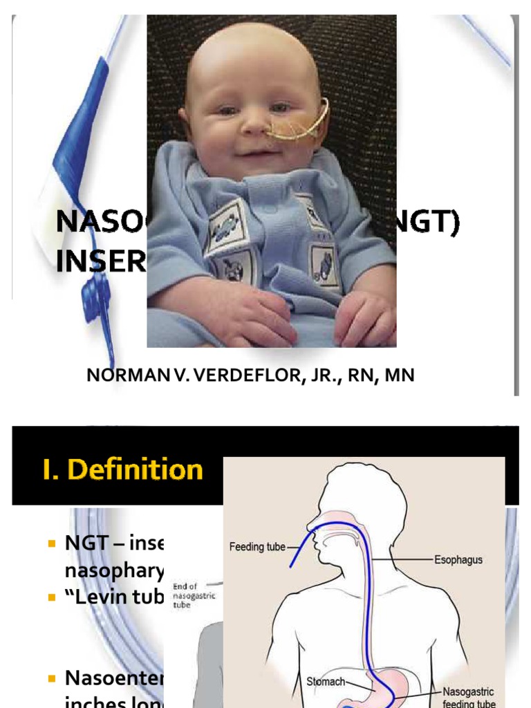 Nasogastric Tube (NGT) Insertion | PDF | Medicine | Clinical Medicine