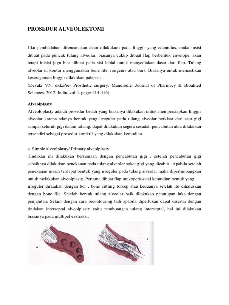 To Alveolektomi | PDF