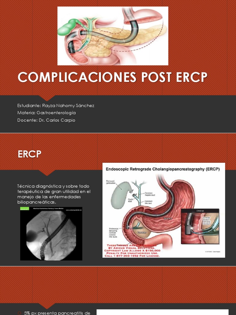 Complicaciones Post ERCP en Gastroenterología | PDF | Sistema exocrino ...
