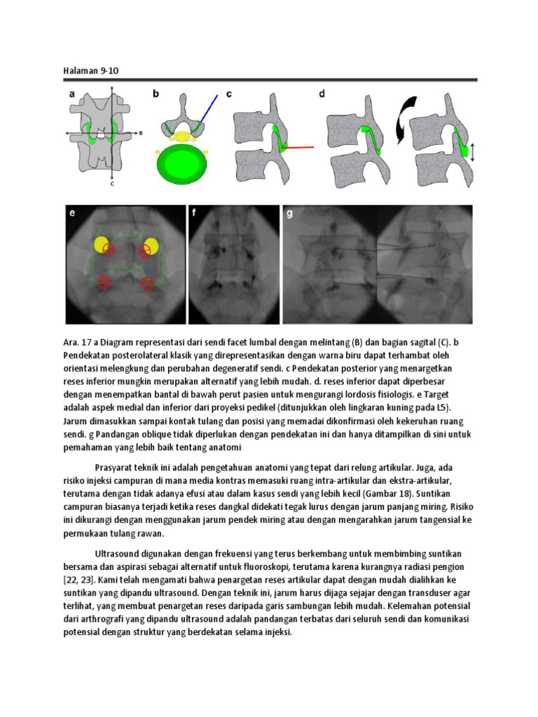 Knee Joint Arthrography | PDF