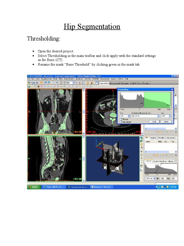 MIMICS Editing Tools | PDF | 3 D Modeling | Image Segmentation