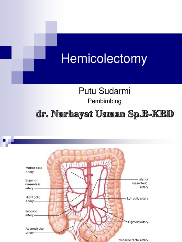 Teknik Operasi Hemicolectomy | PDF