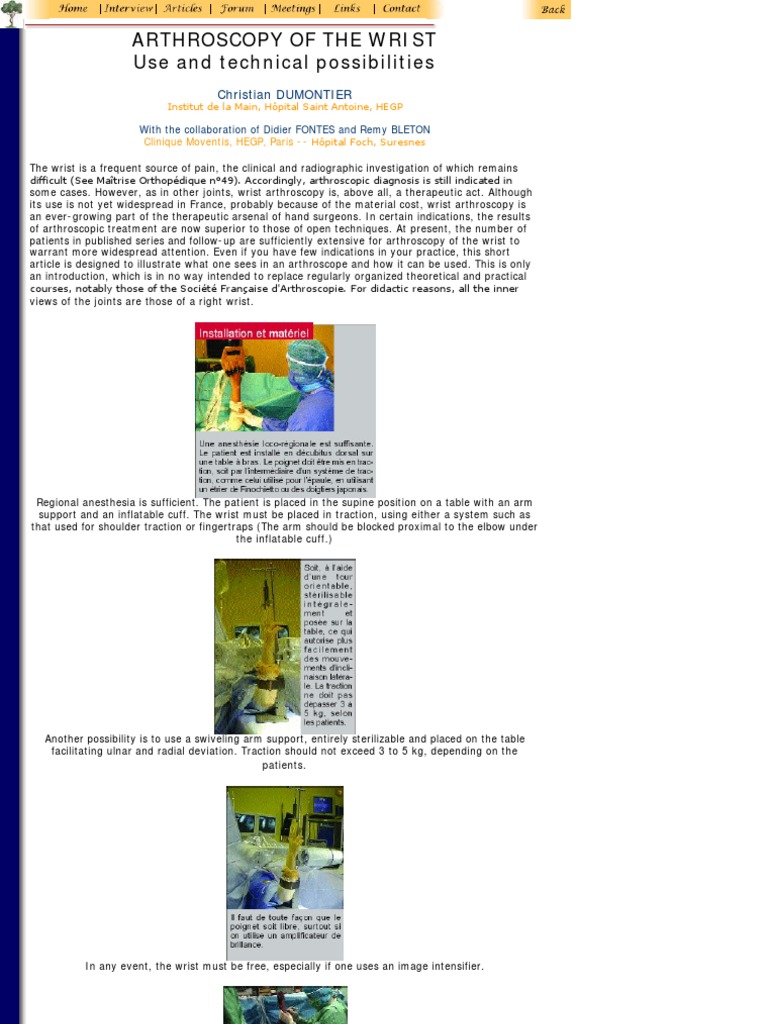 Wrist Arthroscopy DuMontier | PDF | Human Anatomy | Skeletal System