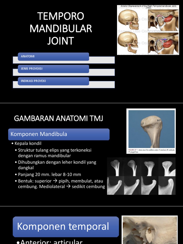 An Overview of Temporomandibular Joint Anatomy and Common Radiographic ...