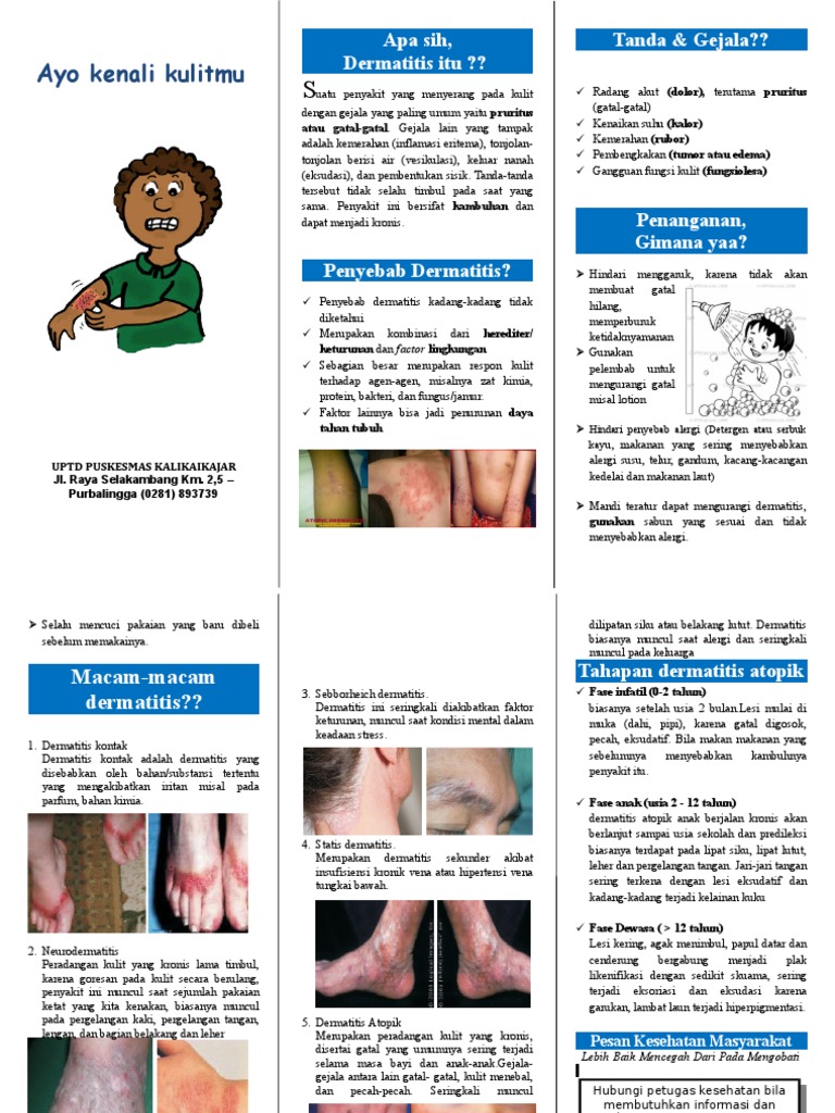 Panduan Mengenal Dermatitis Kulit | PDF