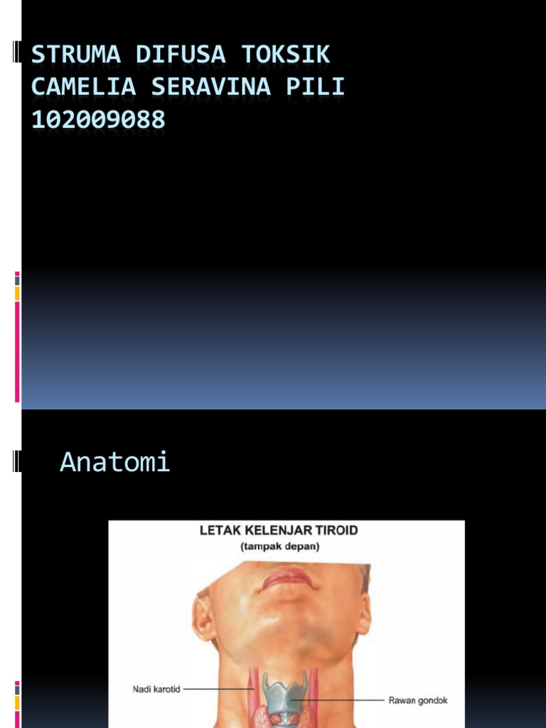 Struma Difusa Toksik | PDF