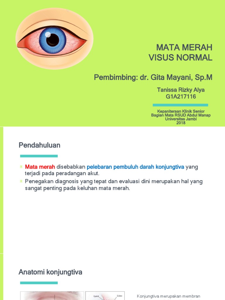 Presentasi Mata Merah Visus Normal Fix | PDF