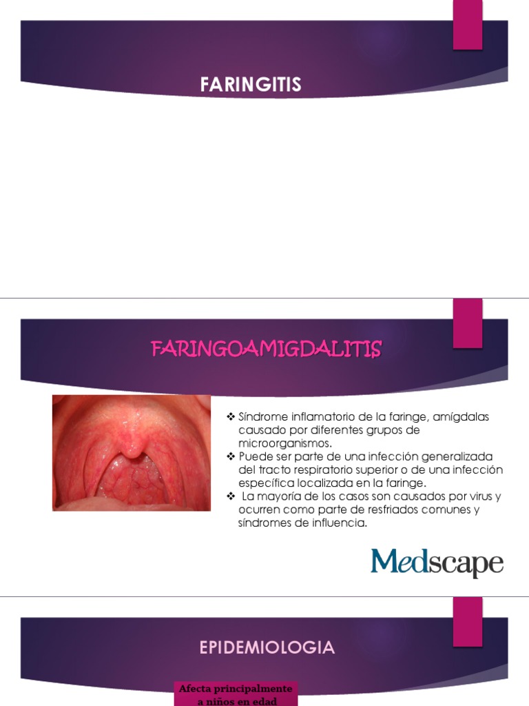 Faringitis Expo | PDF | Resfriado comun | Estreptococo