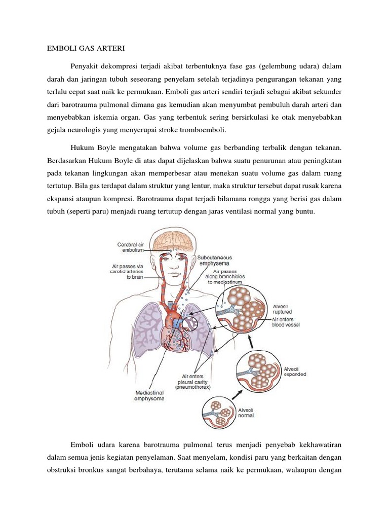 Emboli Gas Arteri | PDF