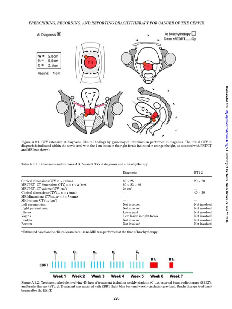 Icru 89 (229-260) | Radiation Therapy | Cervical Cancer