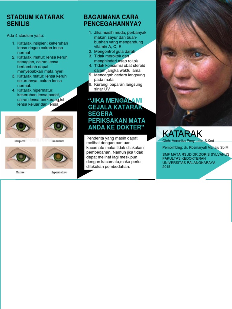 Leaflet Katarak Promosi Kesehatan Mata | PDF | Kesehatan Holistik