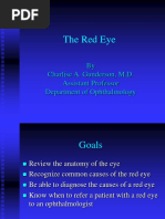 Lid Parallel Conjunctival Folds (LIPCOF) | PDF | Optics | Ophthalmology