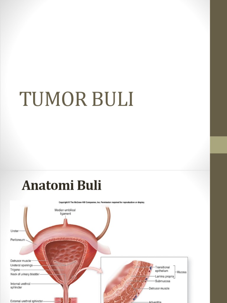CA BULI-dr Sulaiman | PDF | Metastasis | Karsinoma