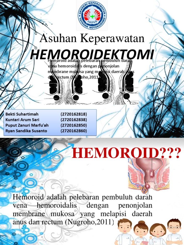 HEMOROIDEKTOMI | PDF