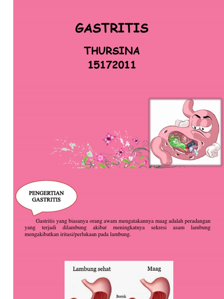 Gastritis (PPT) 1 | PDF