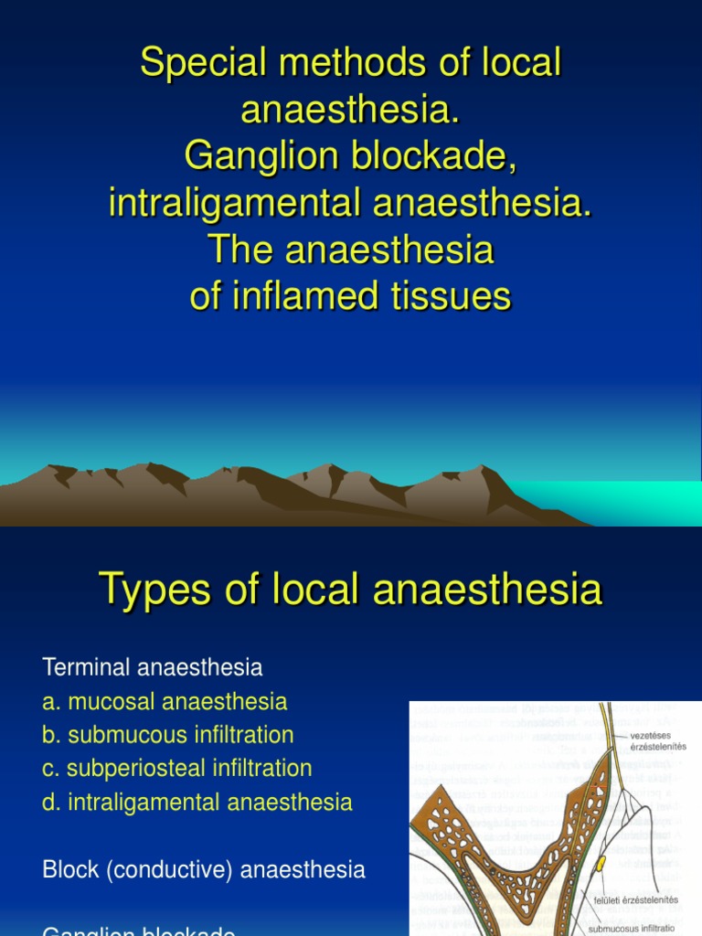 Local Anaesthesia IV. Special Methods of Local Anaesthesia. Ganglion ...