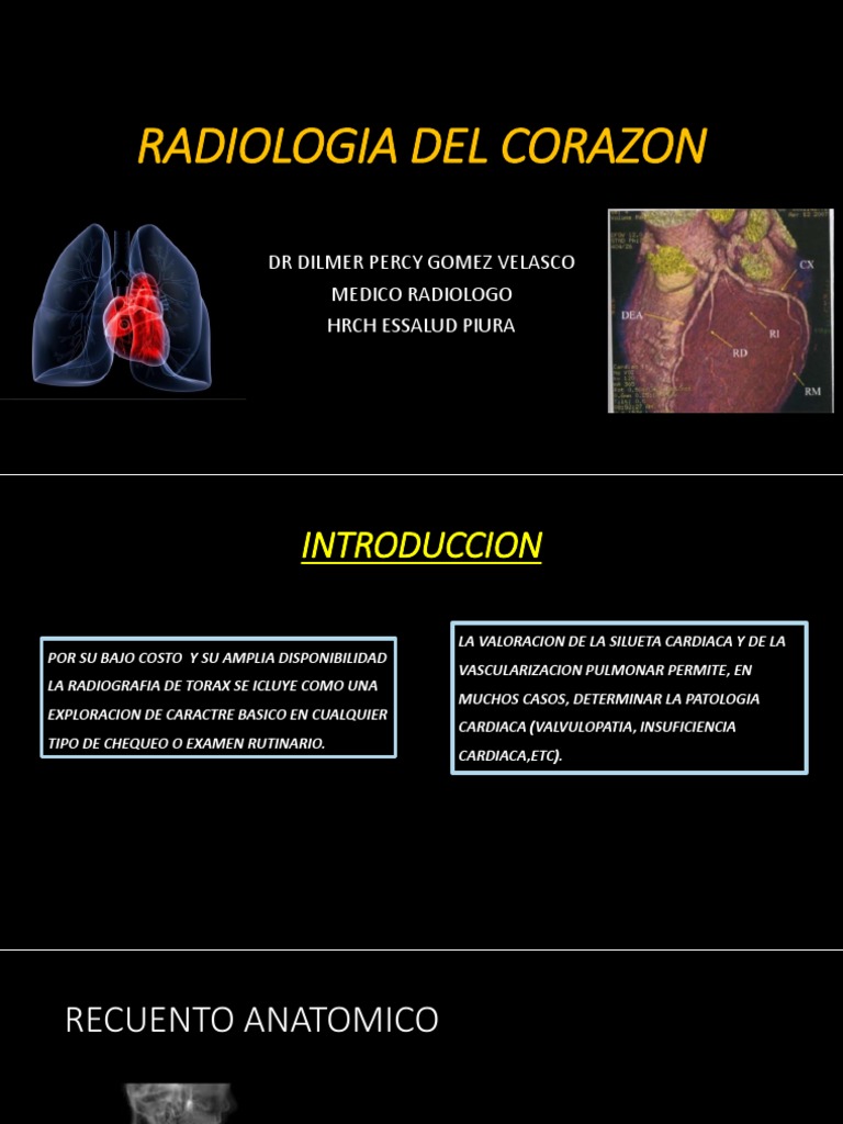 Radiología Cardíaca: Guía Completa | PDF | Corazón | Sistema cardiovascular