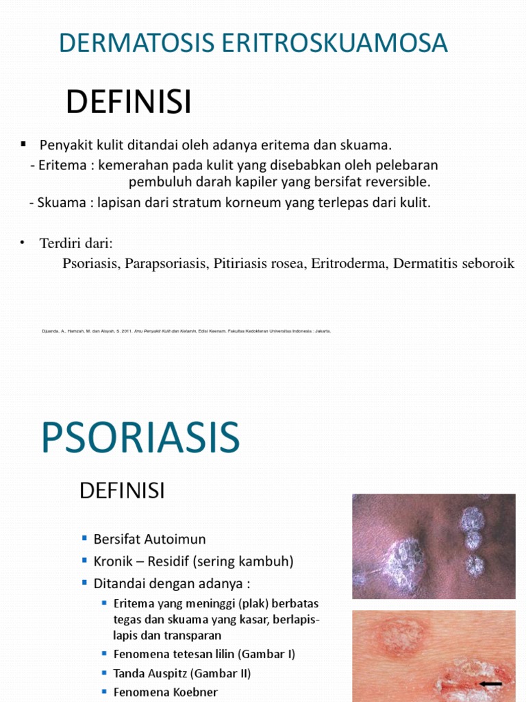 Kulit Merah Berselimut: Eritema dan Skuama pada Dermatosis ...