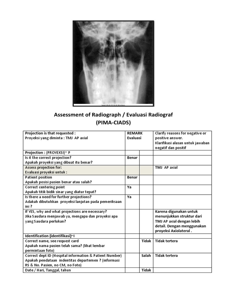 Assessment of Radiograph TMJ 2 | PDF