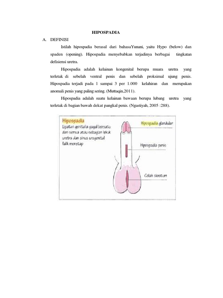 Hipospadia: Definisi, Tipe, dan Penanganan | PDF