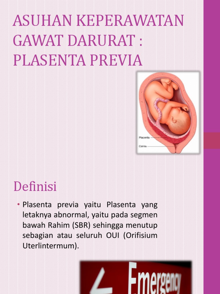 Asuhan Keperawatan Gawat Darurat Plasenta Previa | PDF