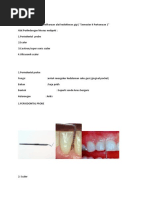 Macam - Macam Fungsi, Gambar, Teknik Alat Probe Periodontal, Probe ...