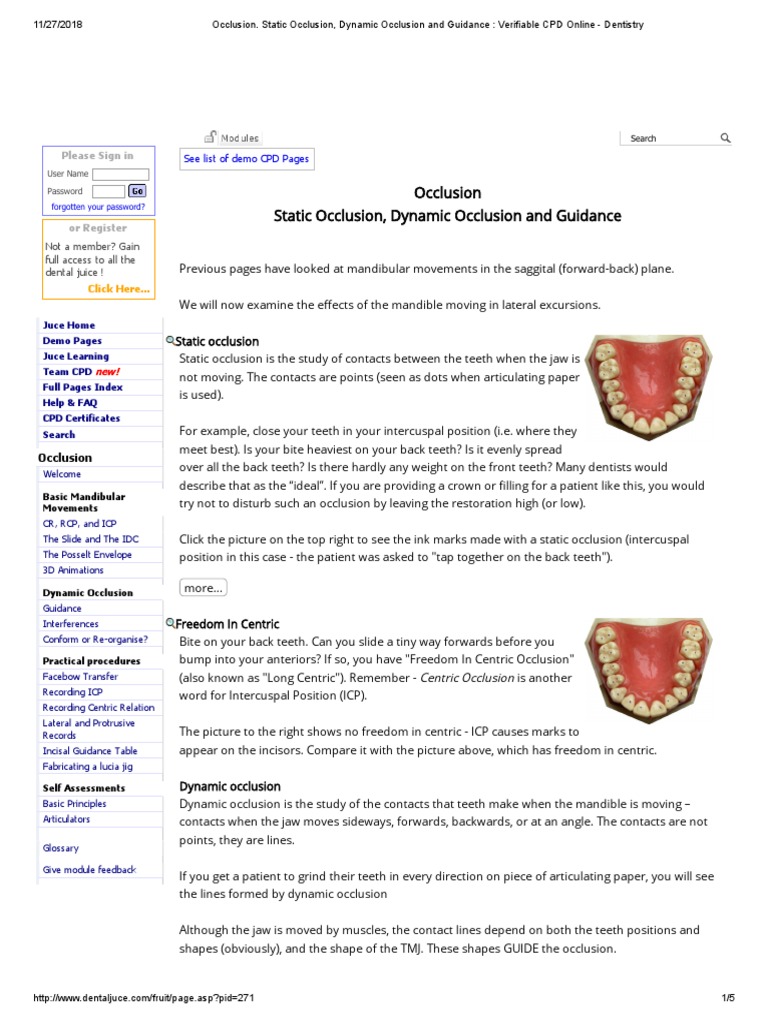 Occlusion. Static Occlusion, Dynamic Occlusion and Guidance ...