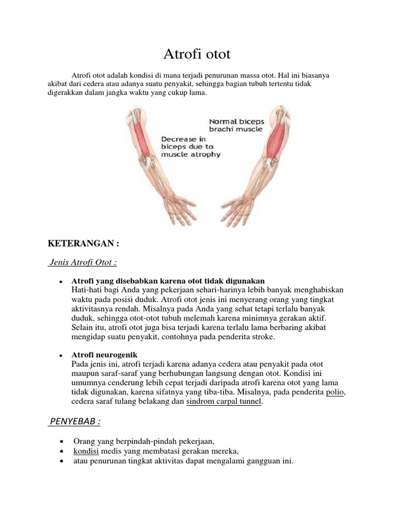 Atrofi Otot