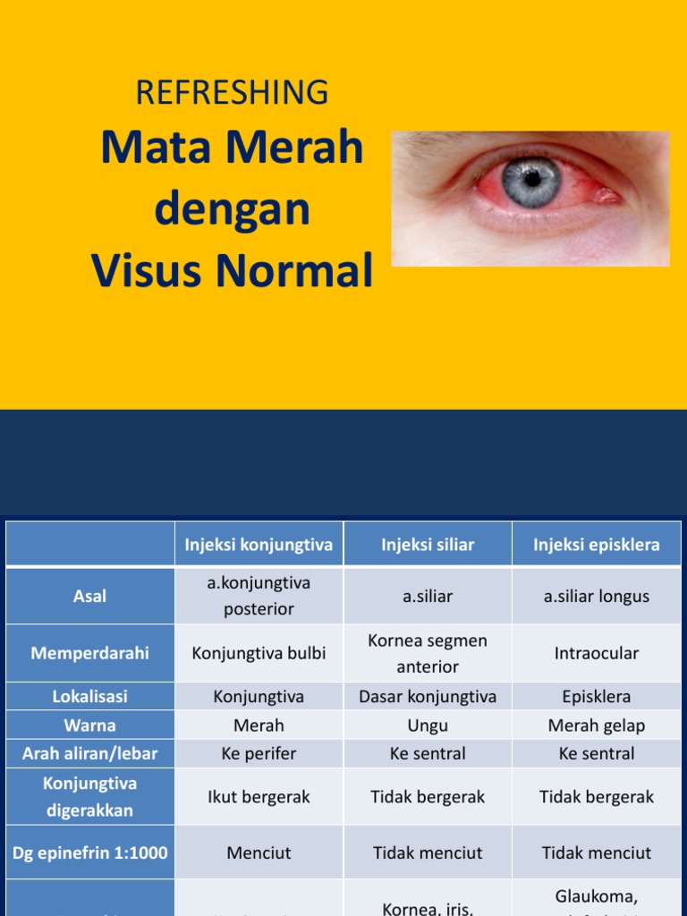 Mata merah visus normal