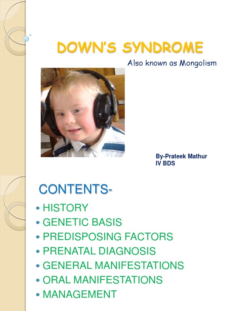 Down'S Syndrome: Also Known As Mongolism | PDF | Human Tooth | Down ...