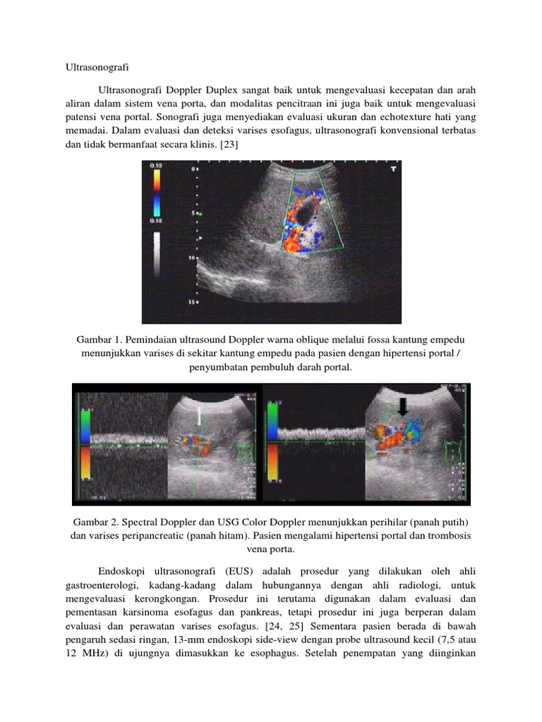 Ultrasonografi Varises Esofagus | PDF