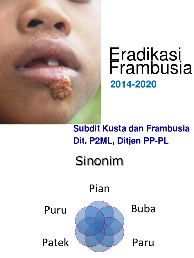 Bahan Sosialisasi Frambusia | PDF