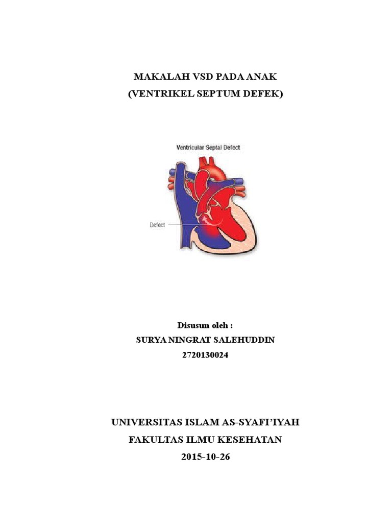 VSD: Defek Septum Ventrikel pada Anak | PDF