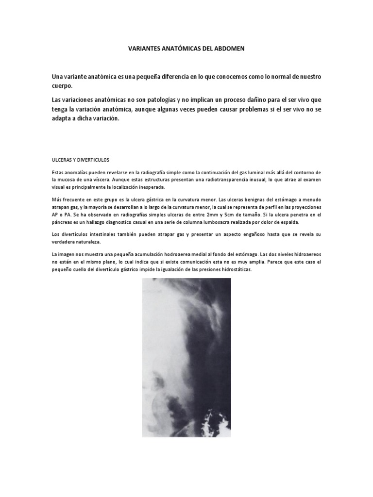 Variantes Anatómicas Abdominales | PDF | Salud y bienestar