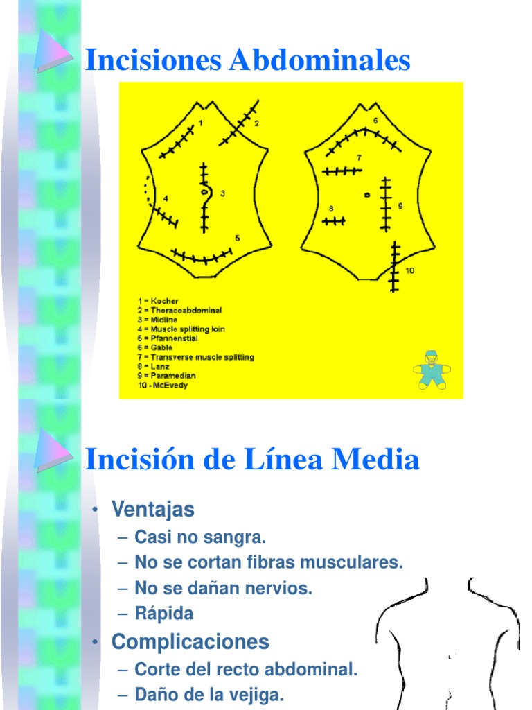 Incisiones Abdominales | Abdomen | Corazón