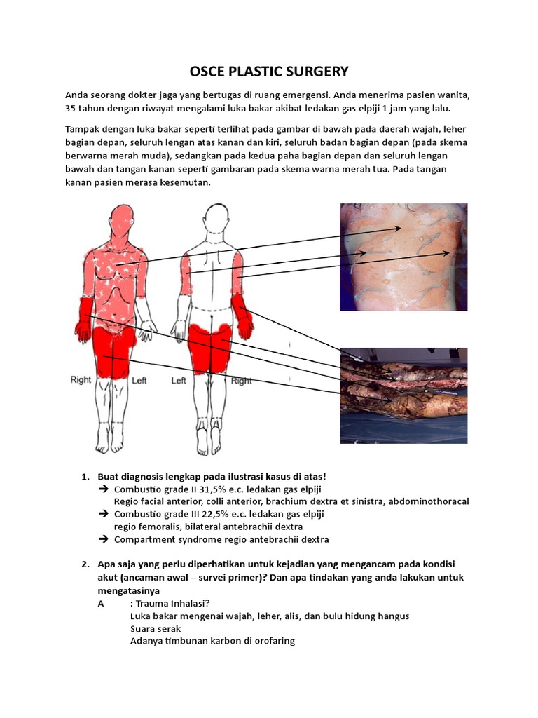 Osce Bedah Plastik | PDF | Kajian Bahasa Asing | Kesehatan Holistik