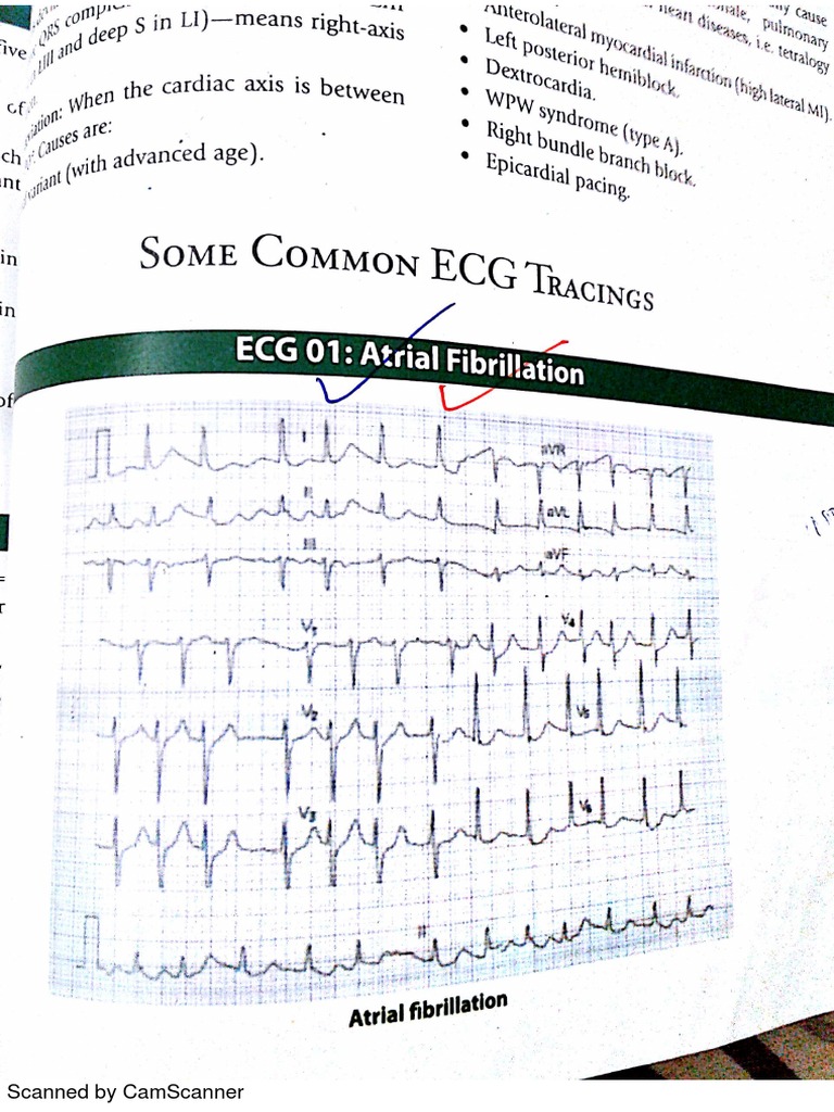 ECG ABM Abdullah | PDF
