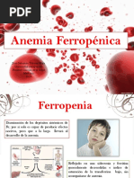 Clase. 3 Metabolismo Del Fe Anemias Hipocromas. A.Ferropénica Anemia de ...