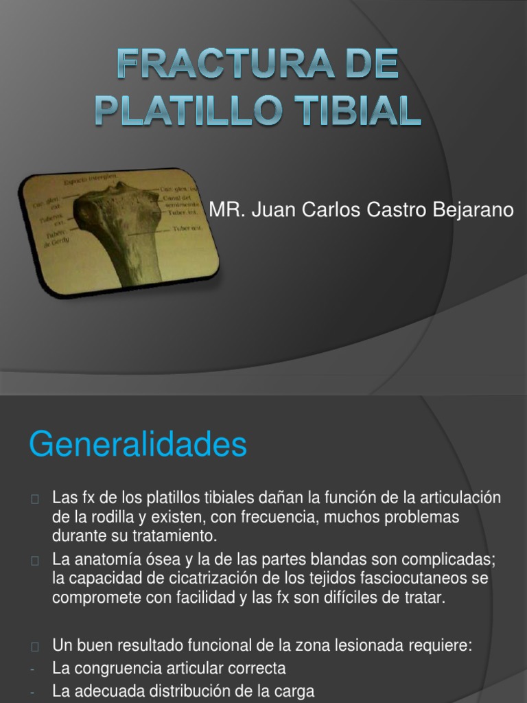 Fractura Platillo Tibial | PDF | Rodilla | Sistema musculoesquelético