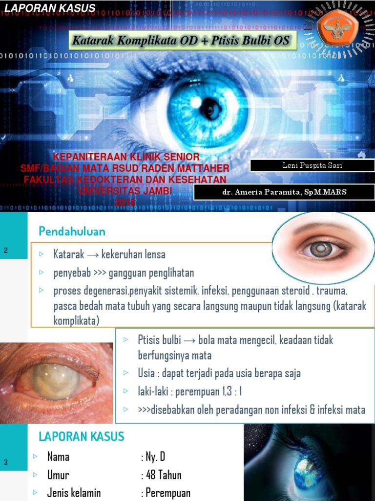 Katarak Komplikata dan Ptisis Bulbi | PDF