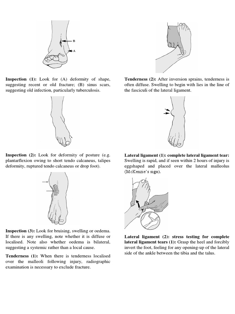 Ankle Examination Orthopaedics Mcrae | PDF | Ankle | Foot