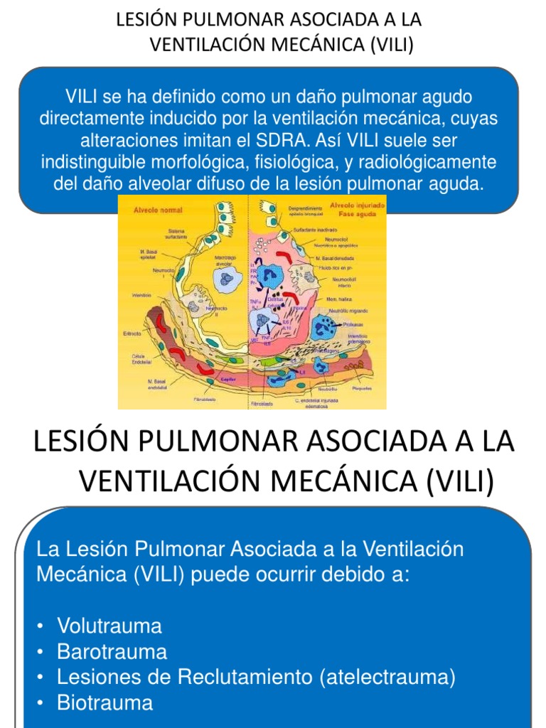 Sdra Volutrauma Atelectrauma | PDF | Inflamación | Citocina
