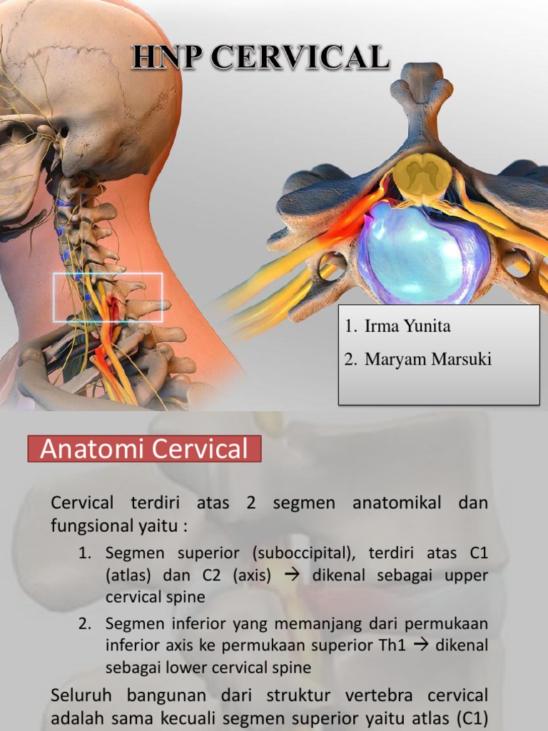 HNP Cervical: Gejala dan Fisioterapi | PDF | Kesehatan Holistik | Sains ...