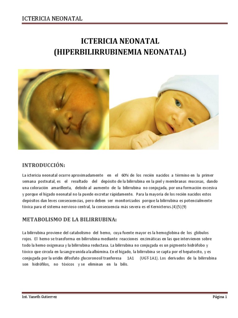 Ictericia Neonatal | PDF | Especialidades Medicas | Medicina CLINICA