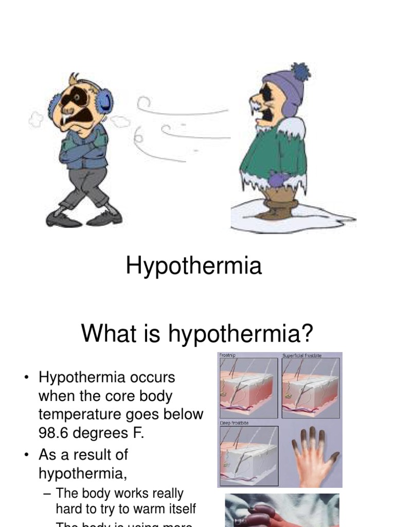 Hypothermia