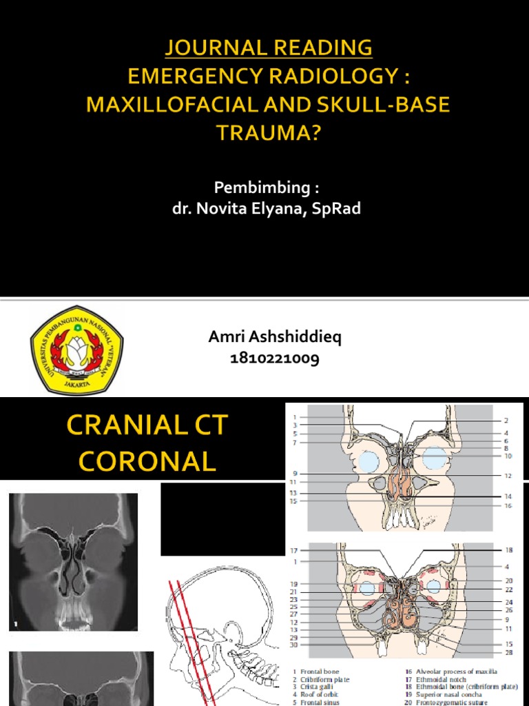 Emergency Radiology | PDF | Ct Scan | Injury